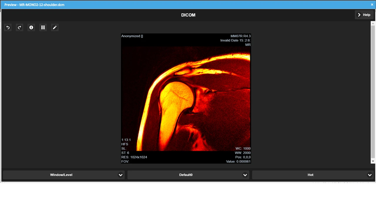Support for DICOM medical image format - LogicalDOC